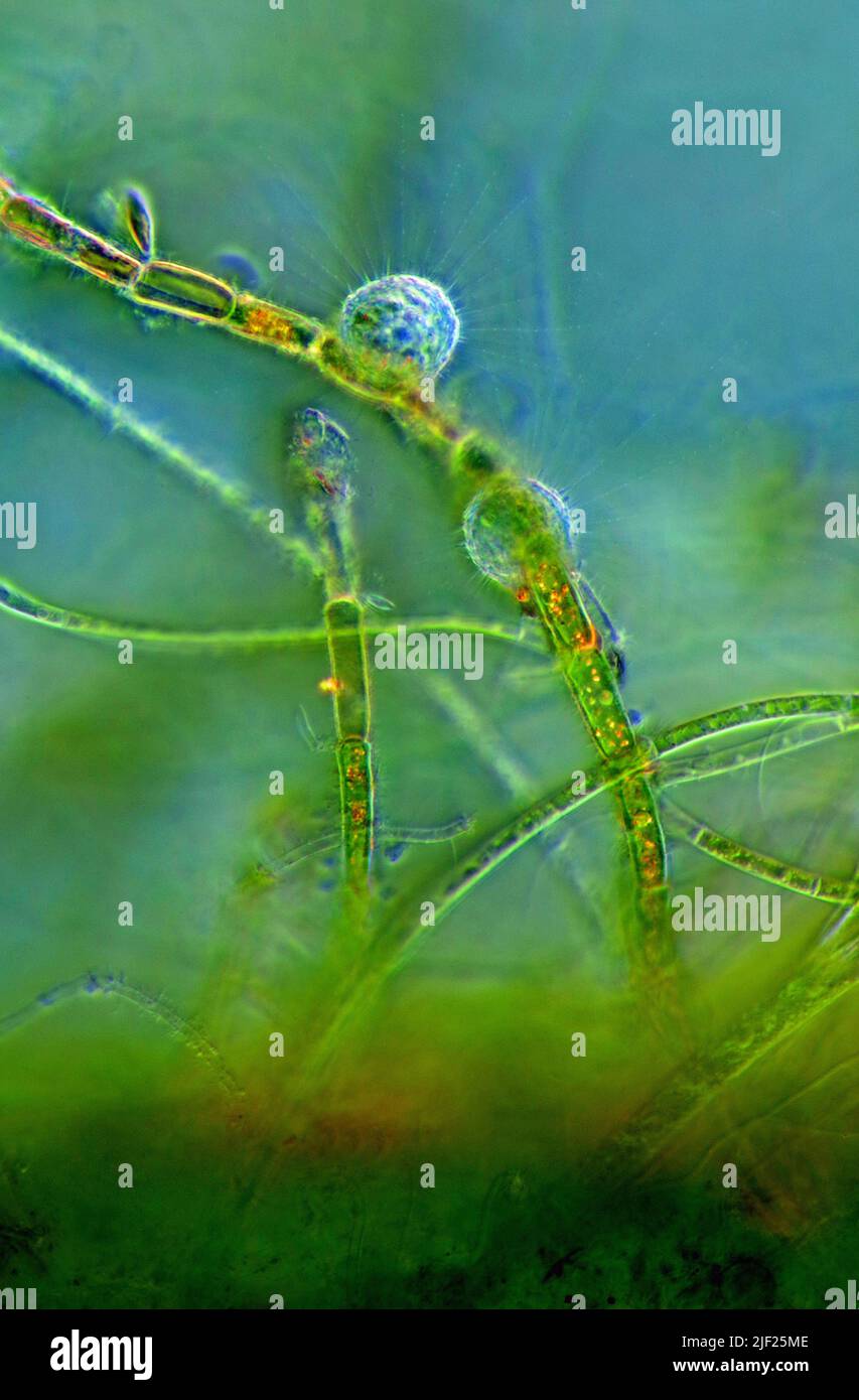 Polarized light micrograph of two tiny heliozoans on green alga thread ...