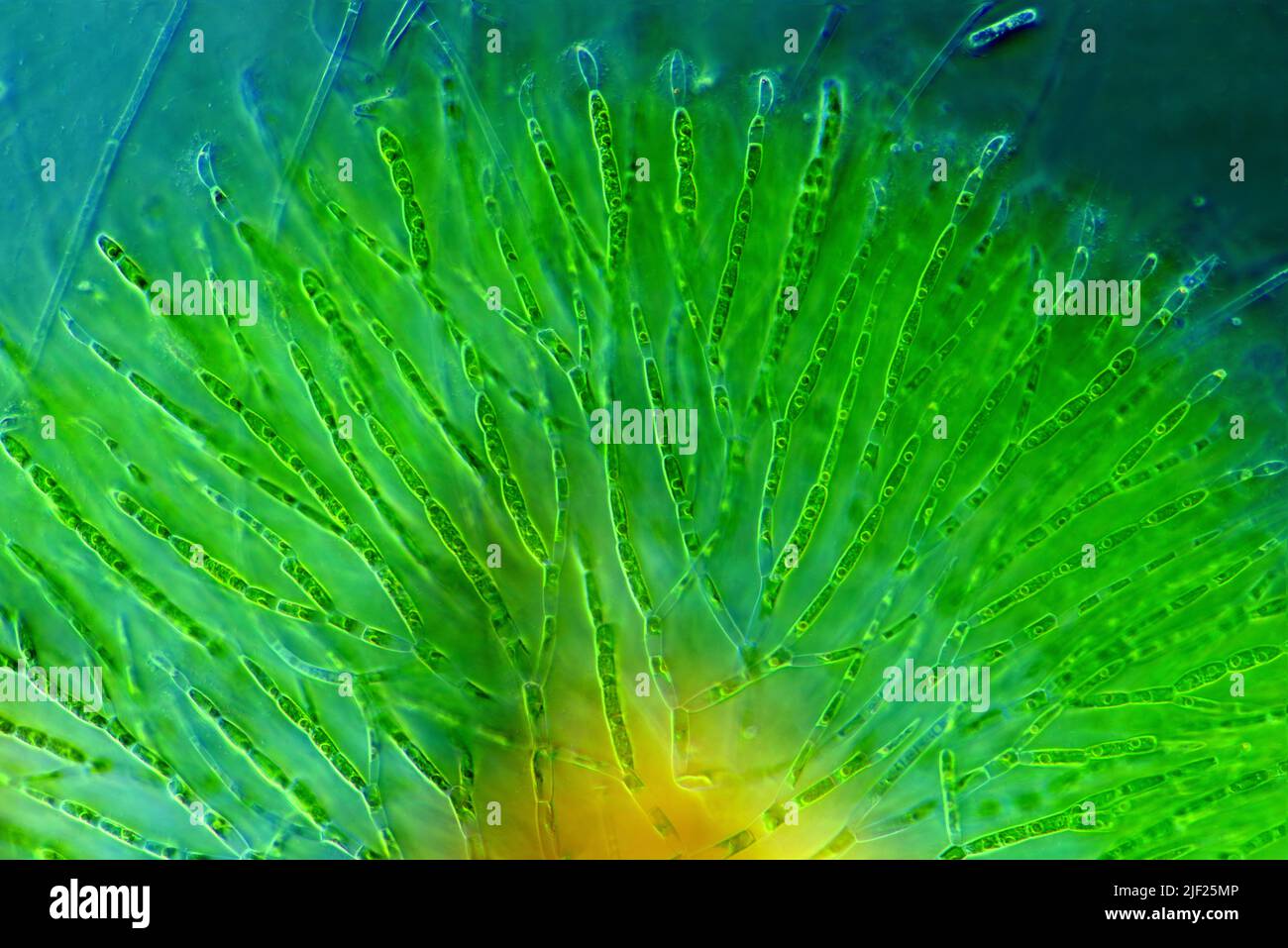 Polarized light micrograph of a green algae colony attached to sand ...