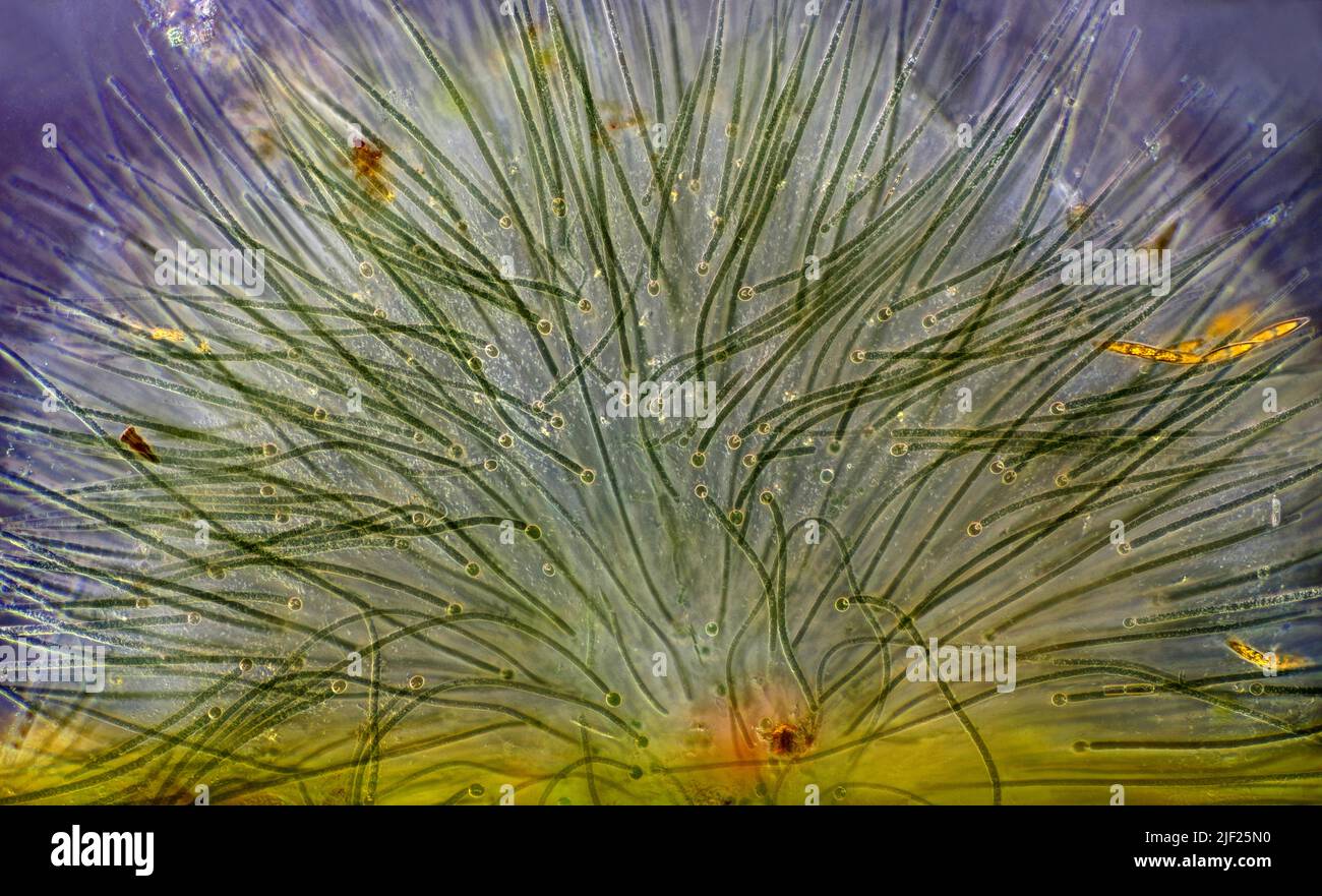 Polarized light micrograph of Rivularia cyanobacteria colony ...