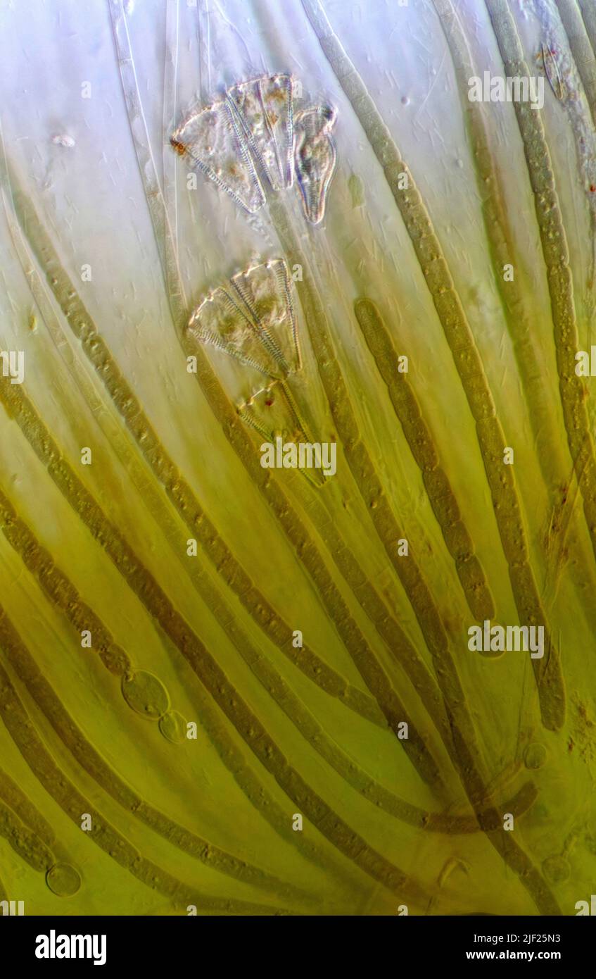 Polarized light of Rivularia cyanobacteria and Gomphonema diatoms ...