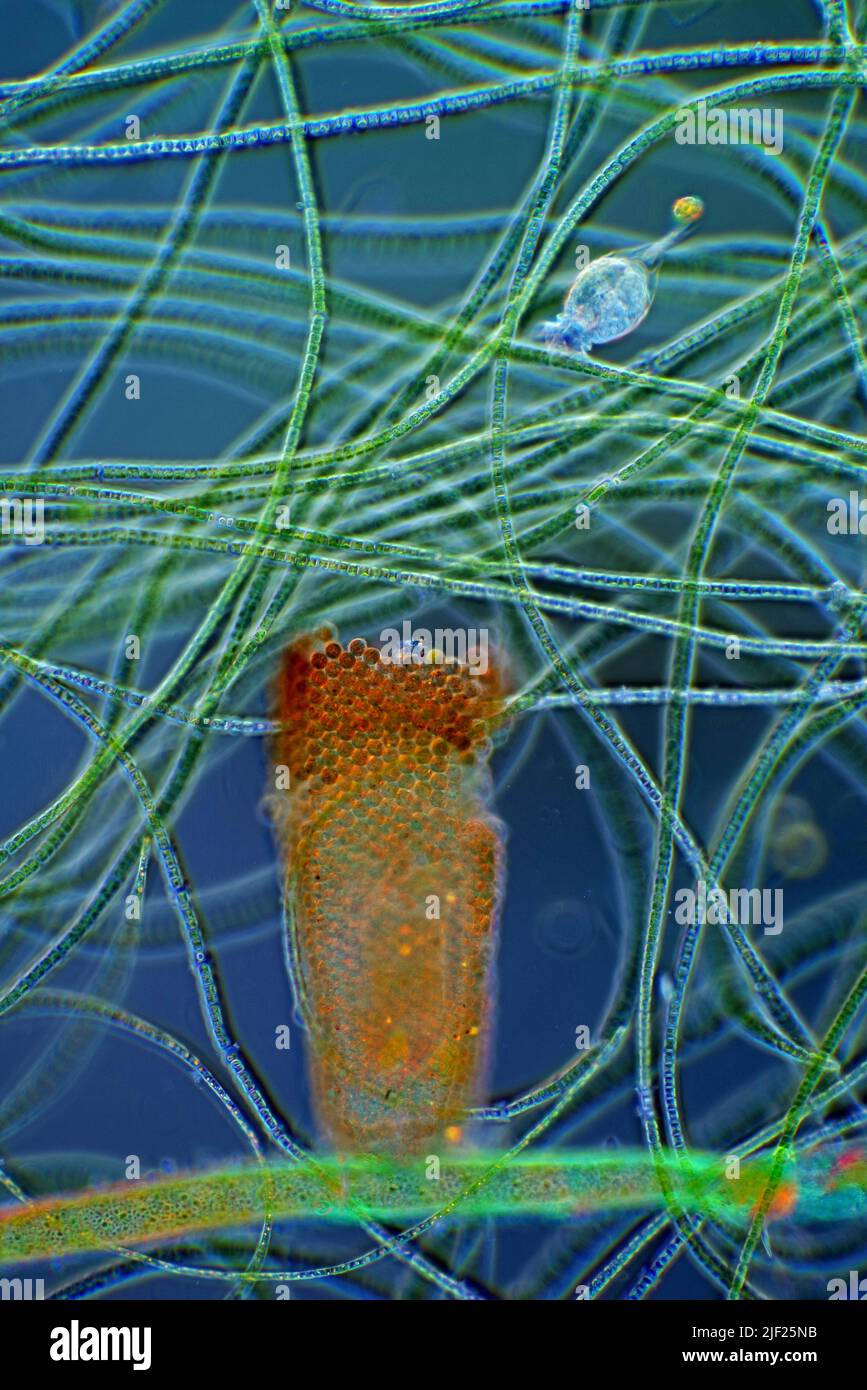 Polarized light micrograph of Floscularia rotifer among filamentous ...