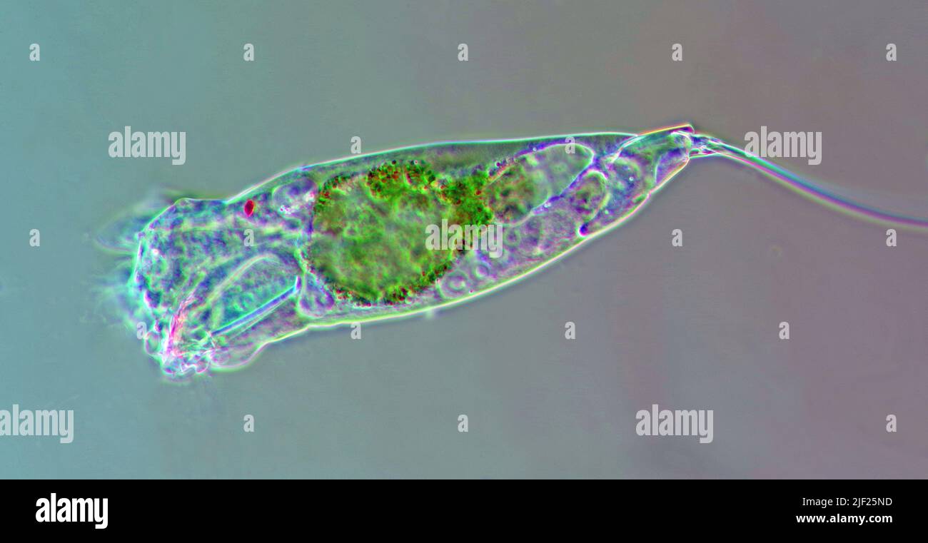 Polarized light micrograph of a rotifer. Rotifers are microscopic ...