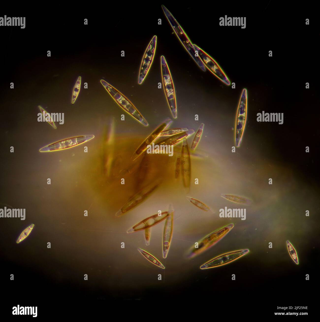 Dark field light micrograph of Navicula diatoms above sand grain ...