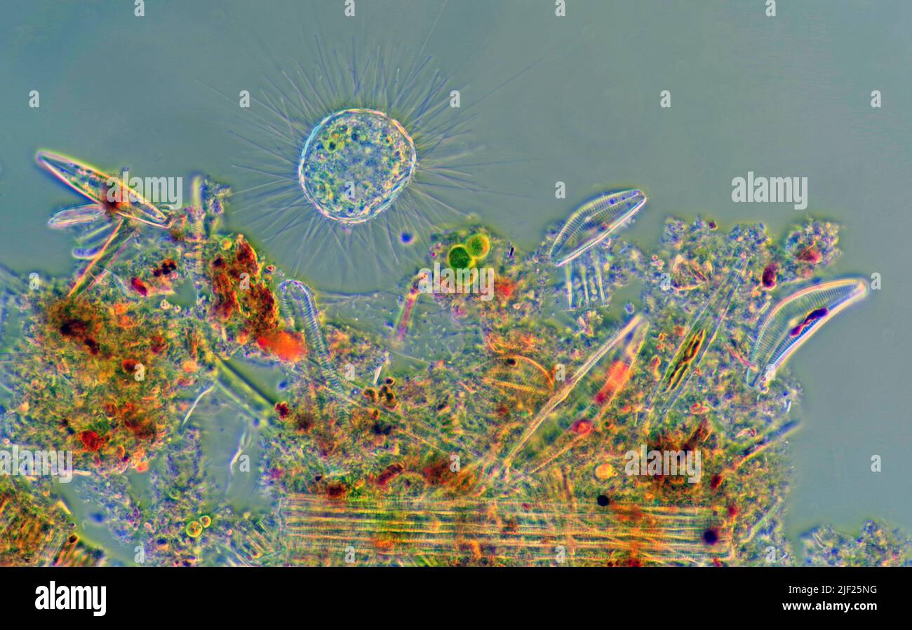 Polarized light micrograph of a tiny heliozoan and biological debris ...
