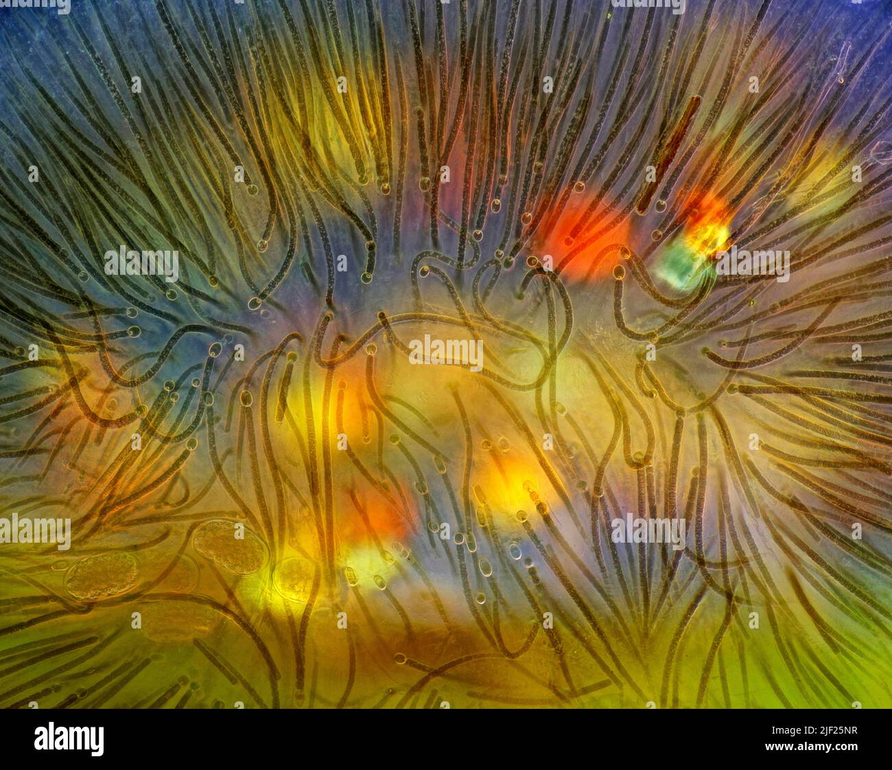 Polarized light micrograph of Rivularia cyanobacteria. Cyanobacteria ...