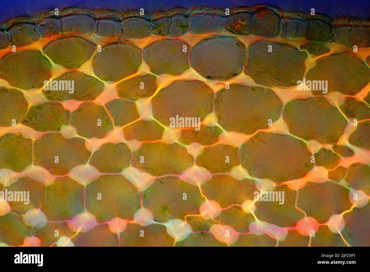 Polarized light micrograph of angular collenchyma in Impatiens sp ...