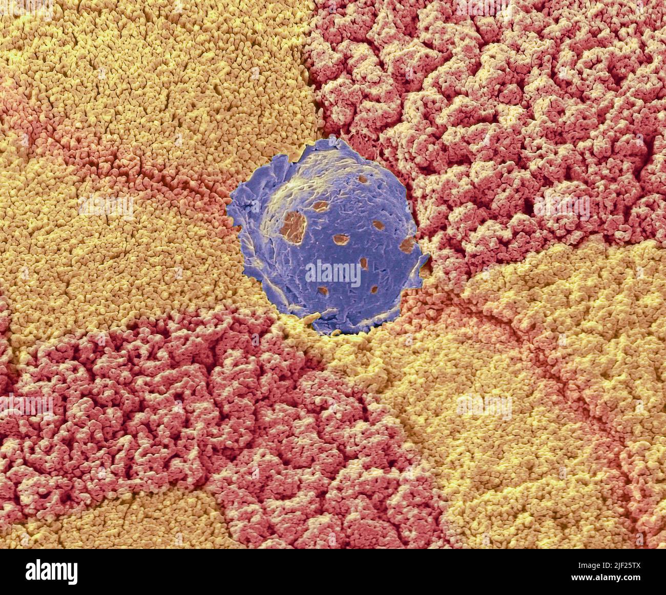 Colon. Colour scanning electron micrograph (SEM) of the wall of the ...