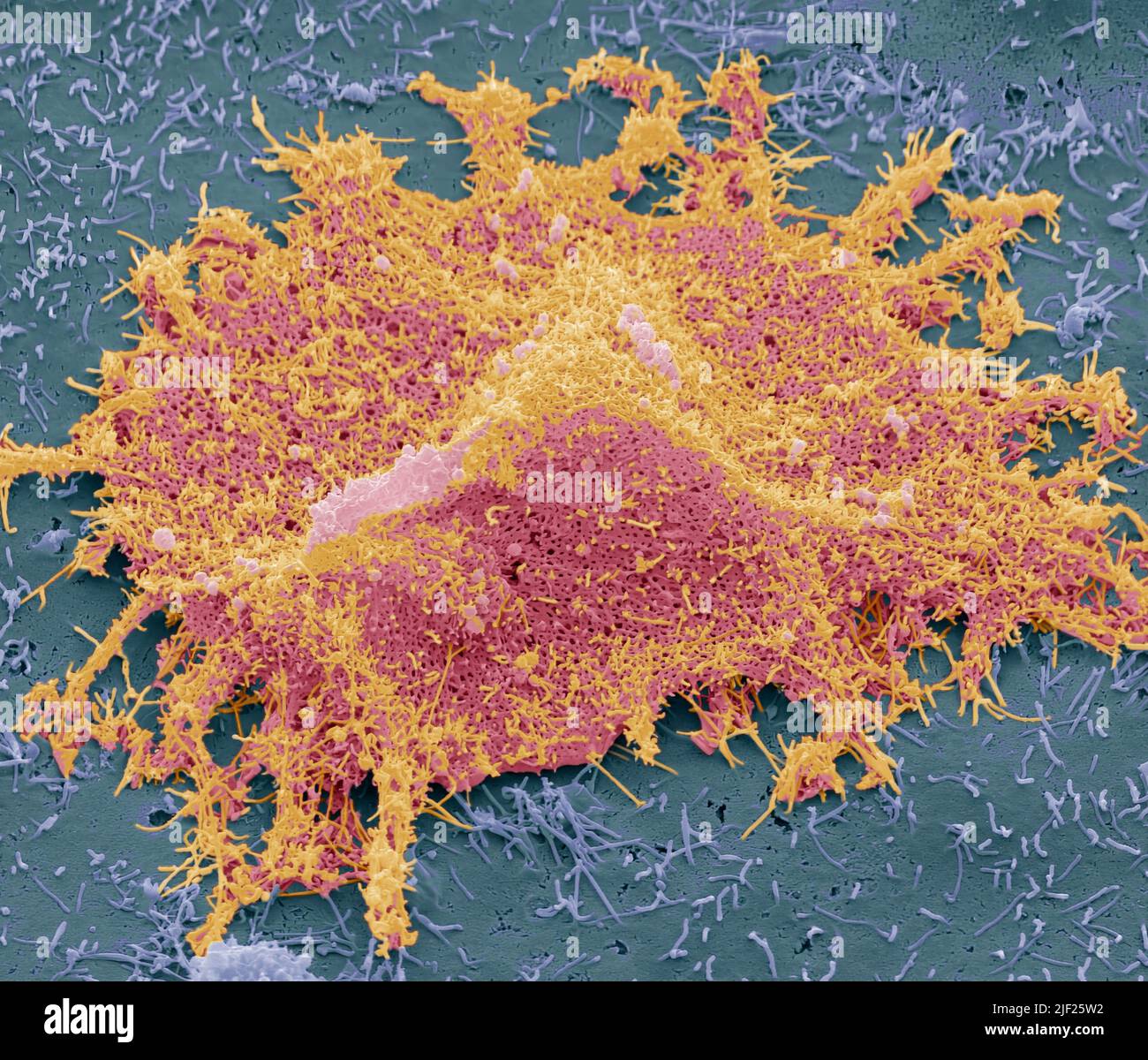 Ebola virus. Coloured scanning electron micrograph (SEM) of Ebola virus ... Ebola virus. Coloured scanning electron micrograph (SEM) of Ebola virus ...