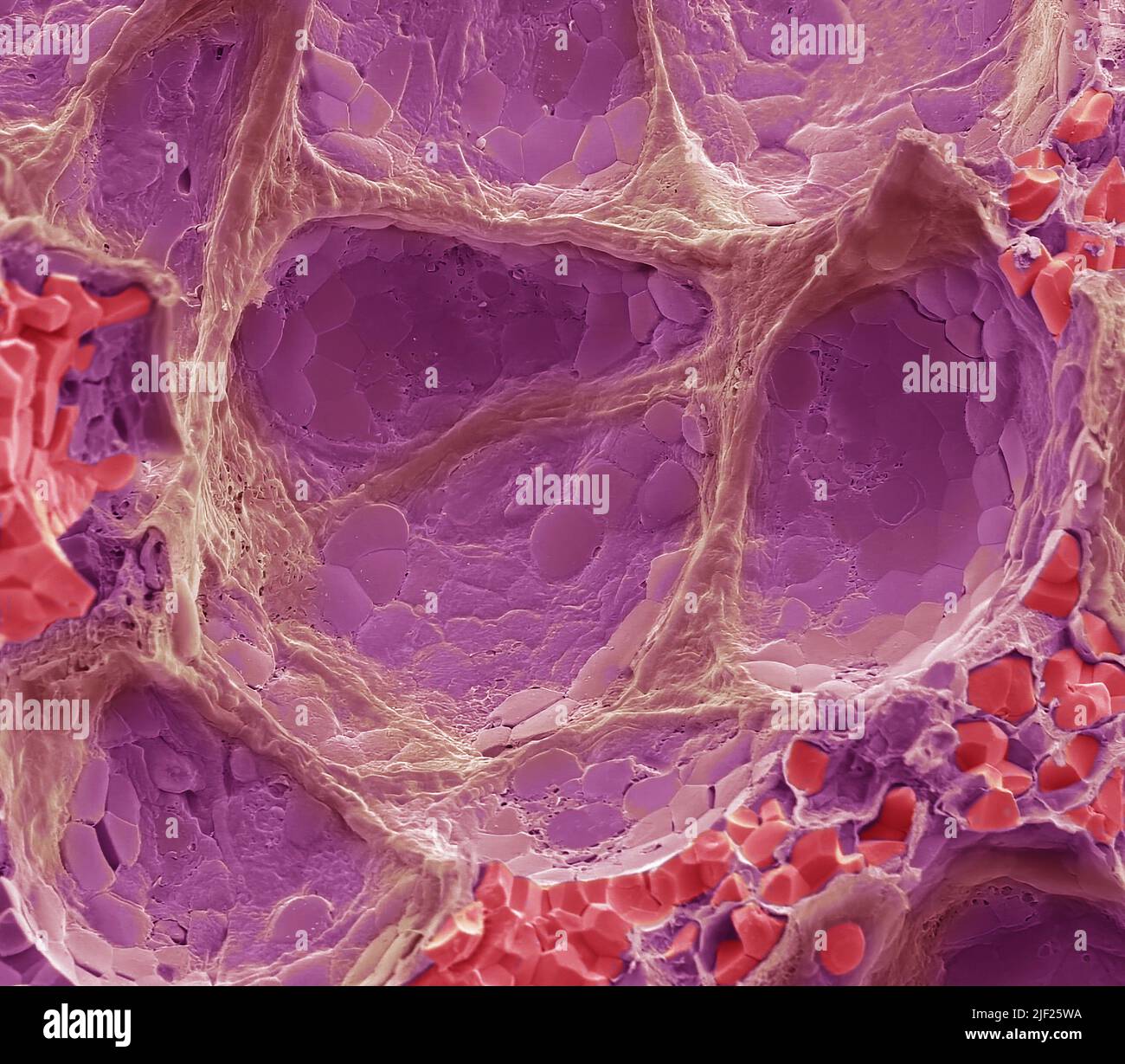 Alveolus. Coloured scanning electron micrograph (SEM) of a freeze ...