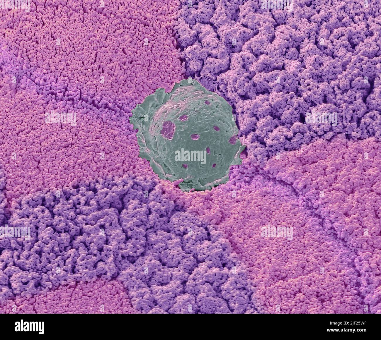 Colon Colour Scanning Electron Micrograph Sem Of The Wall Of The Large Intestine Colon