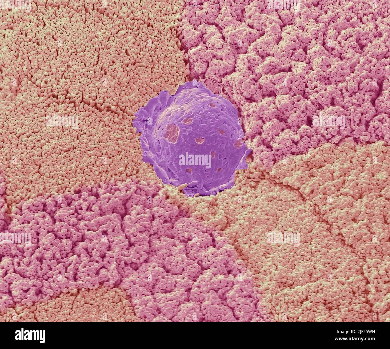 Colon. Colour scanning electron micrograph (SEM) of the wall of the ...