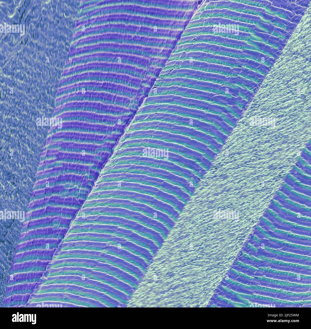 Striated muscle. Coloured scanning electron micrograph (SEM) of a freeze-fractured mammalian ...