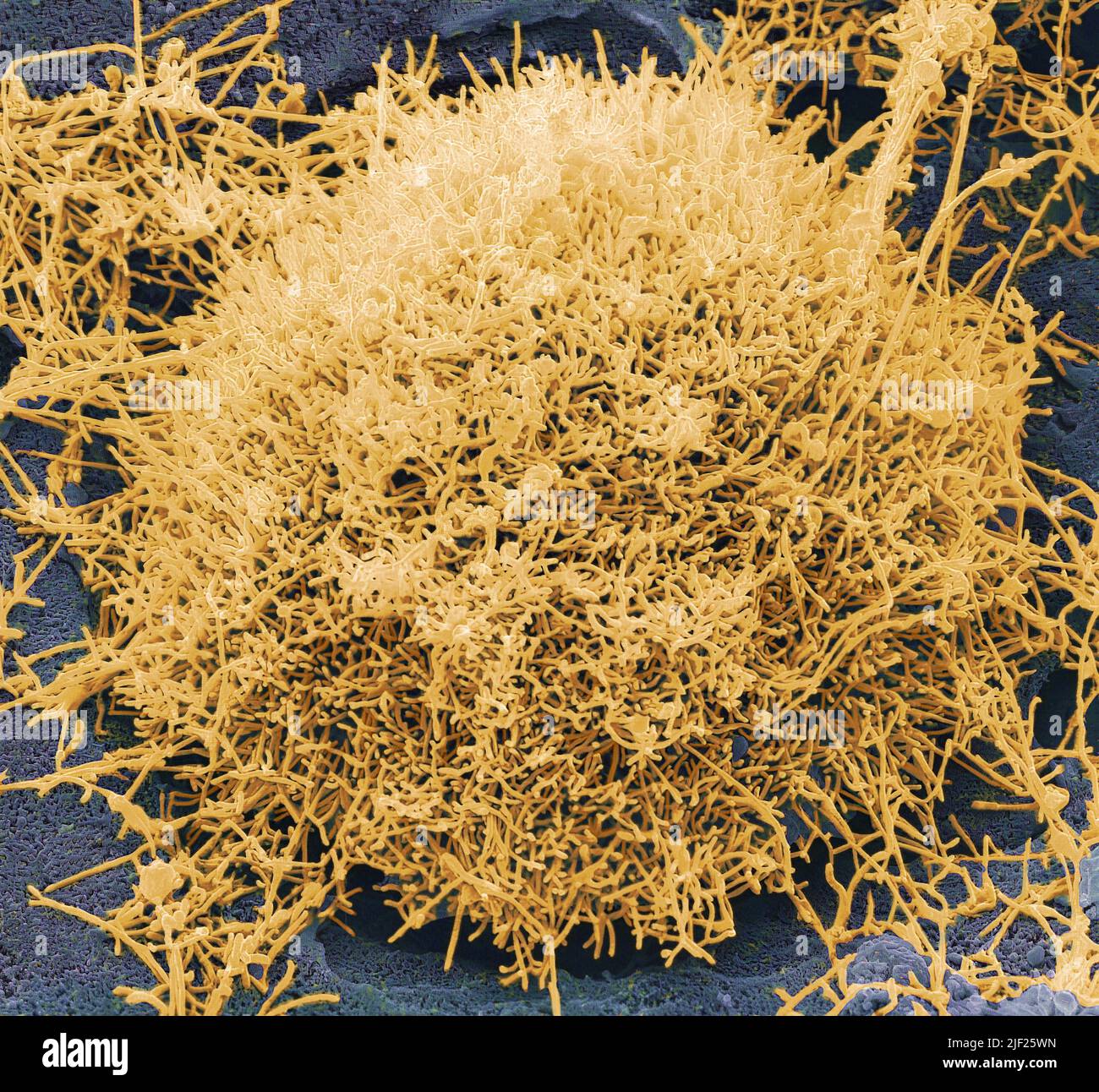 Ebola virus. Coloured scanning electron micrograph (SEM) of Ebola virus ...