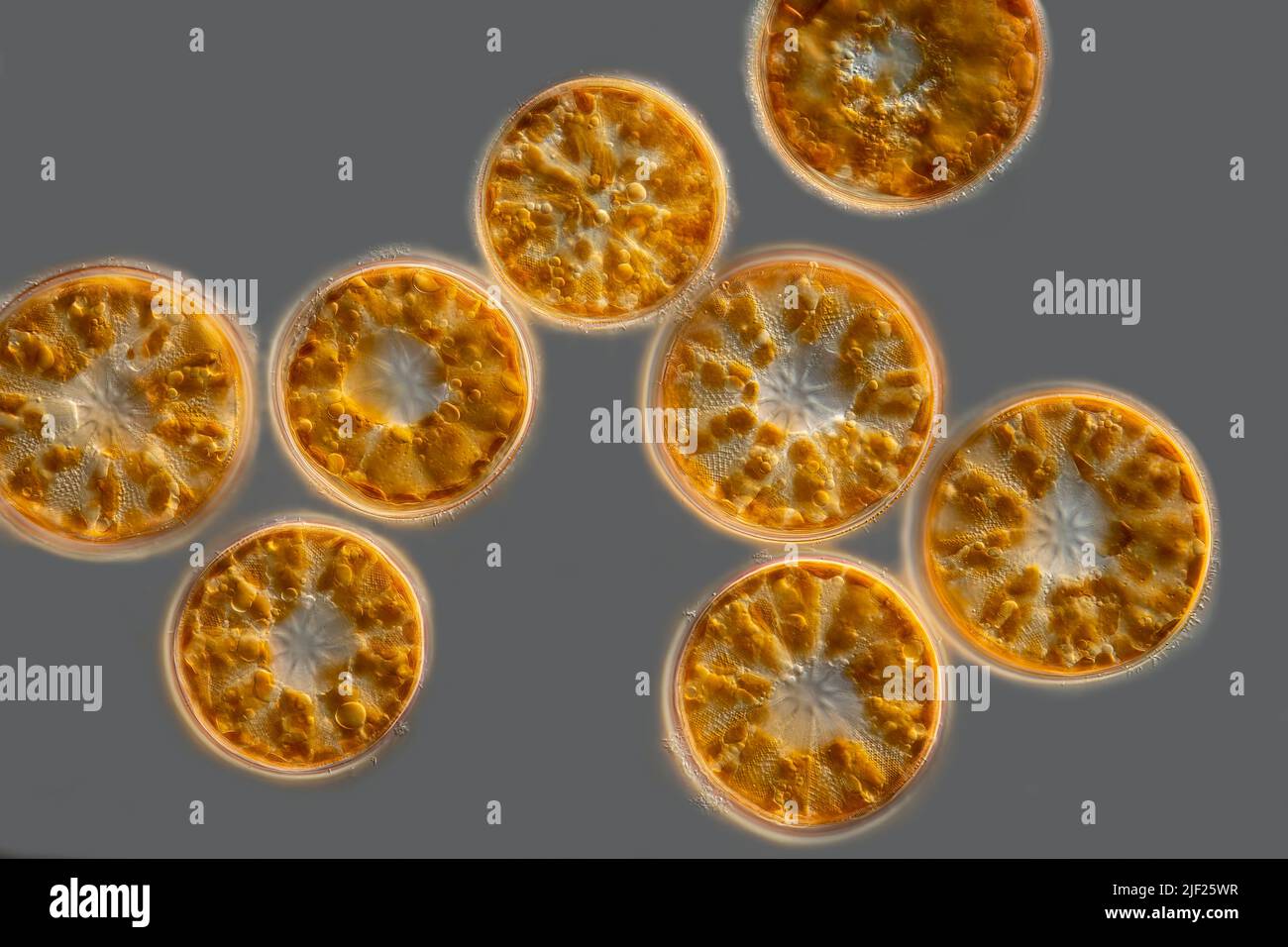 Differential interference contrast (DIC) light micrograph of ...