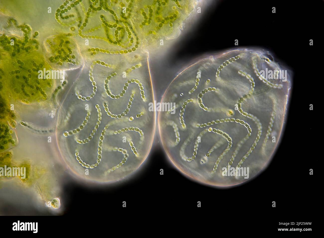 Differential interference contrast (DIC) light micrograph of Nostoc sp ...