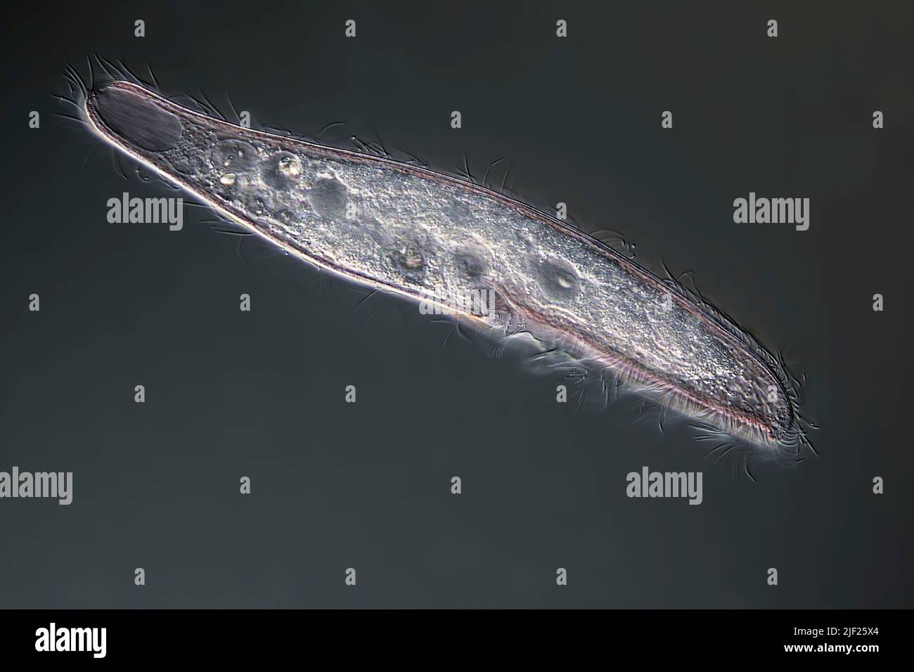 Differential interference contrast (DIC) light micrograph of a ...