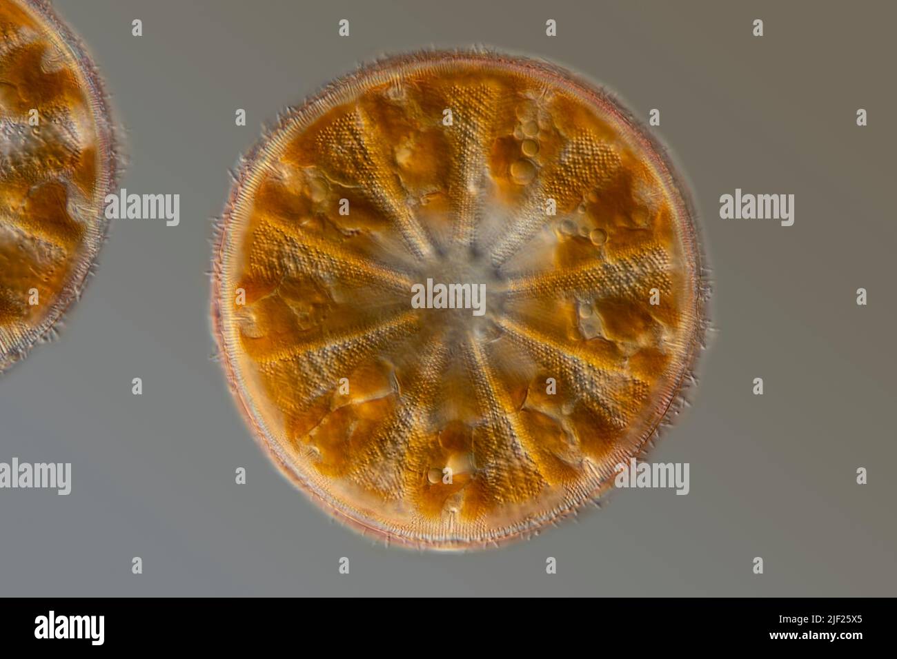Differential interference contrast (DIC) light micrograph of ...