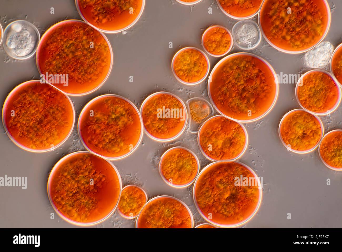 Differential interference contrast (DIC) light micrograph of Haematococcus sp. algae ...