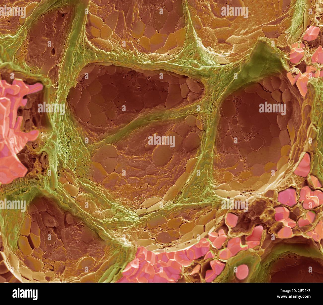 Alveolus. Coloured scanning electron micrograph (SEM) of a freeze ...