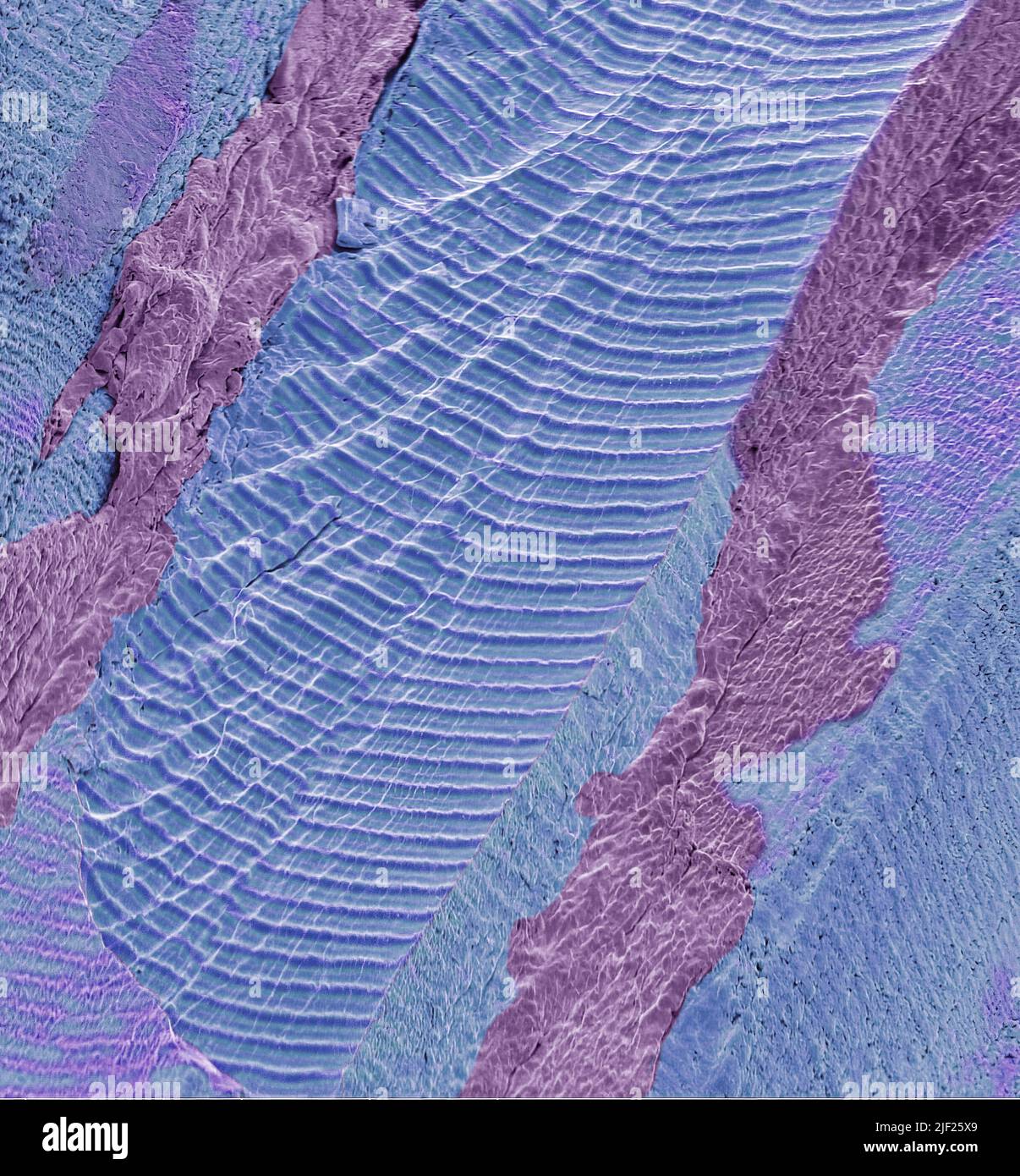 Striated muscle. Coloured scanning electron micrograph (SEM) of a freeze-fractured mammalian ...