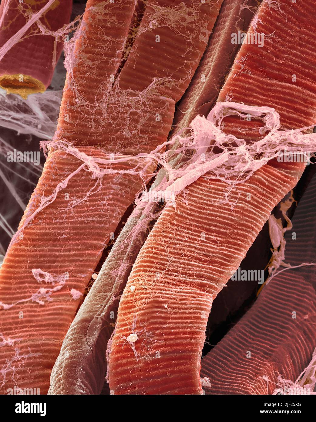 Coloured scanning electron micrograph (SEM) of tendons and other ...