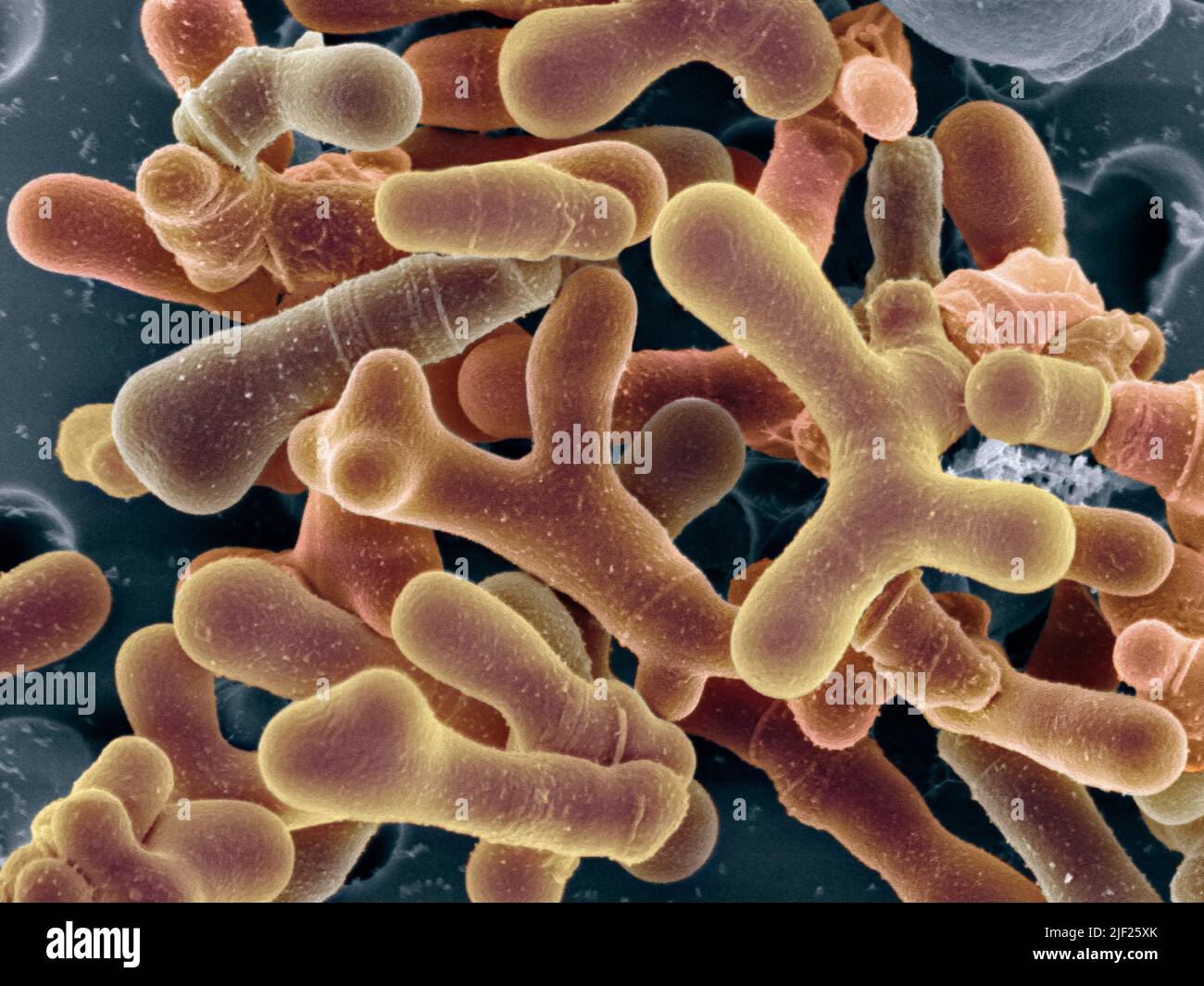 Coloured scanning electron micrograph (SEM) of Bifidobacterium animalis ...