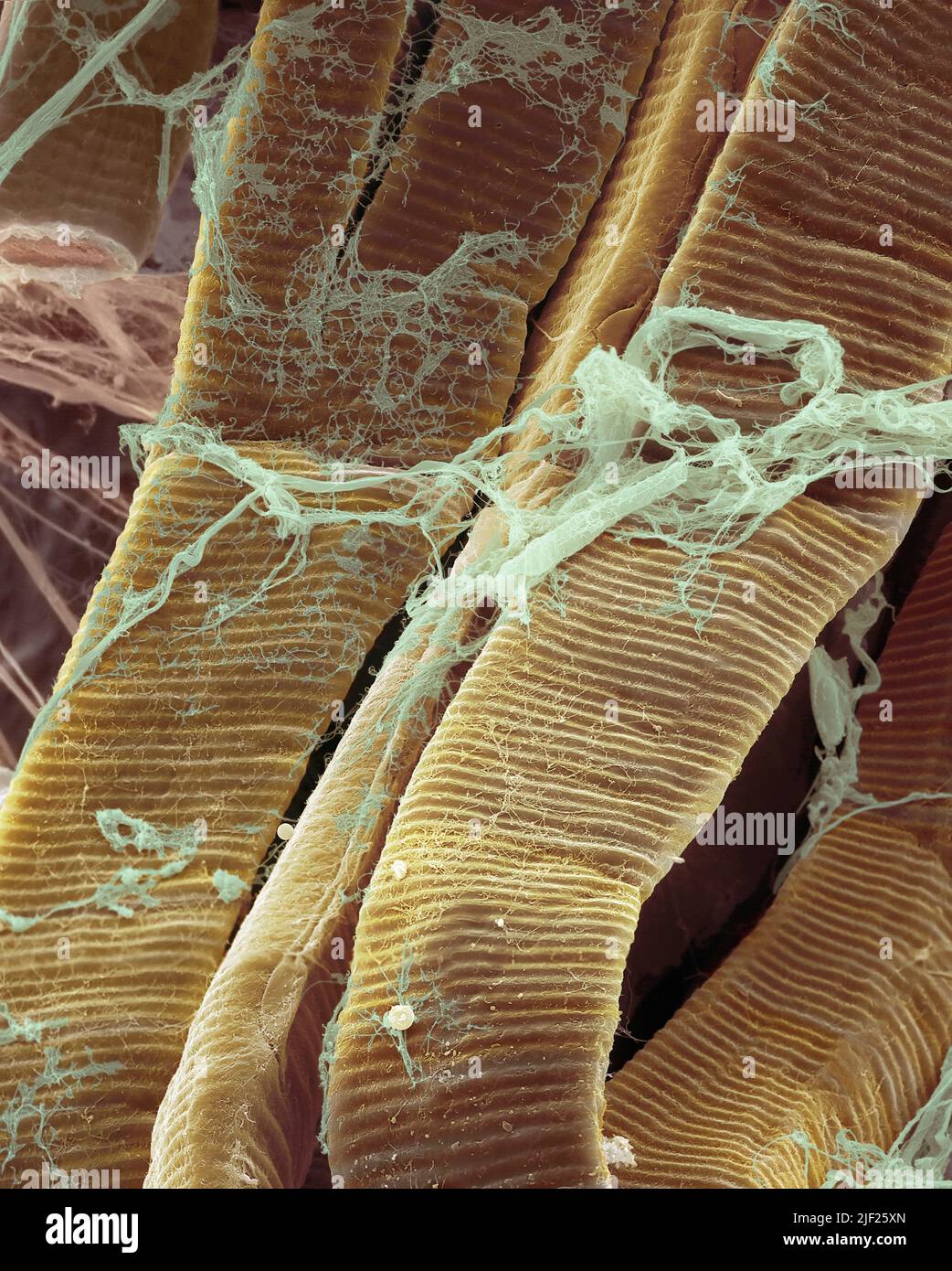 Coloured scanning electron micrograph (SEM) of tendons and other ...