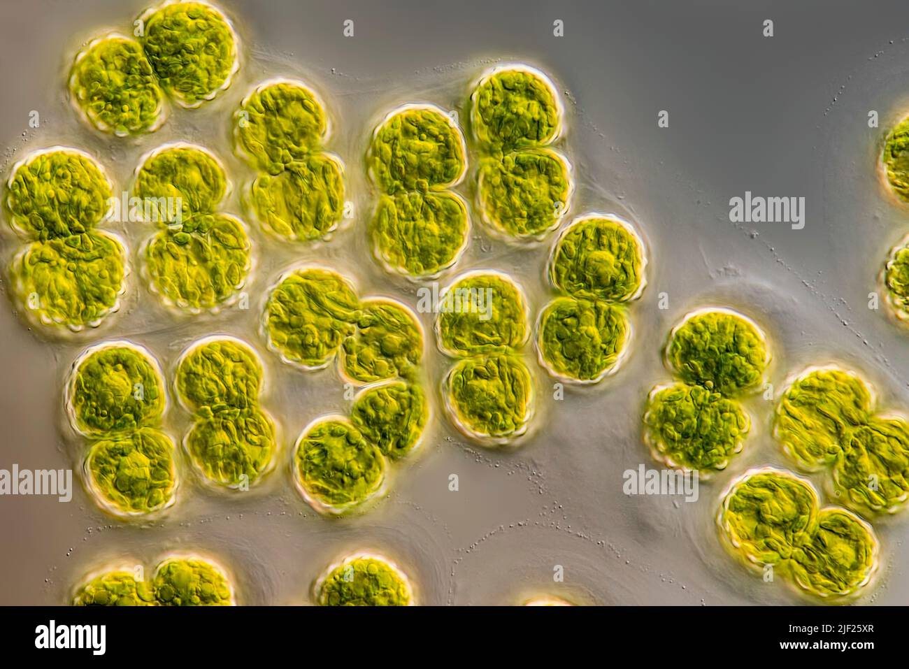 Differential interference contrast (DIC) light micrograph of Cosmarium ...