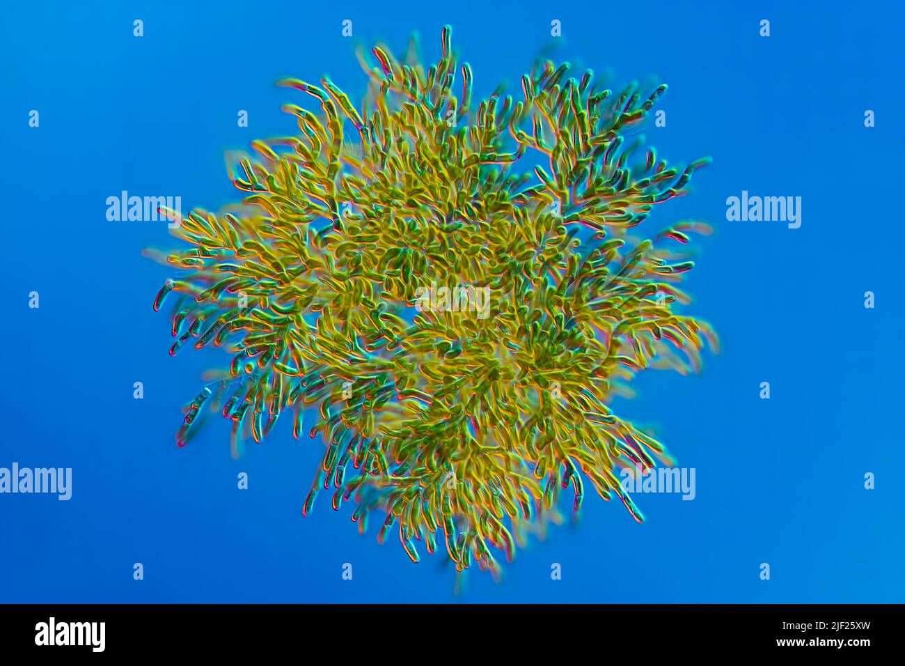 Differential interference contrast (DIC) light micrograph of Microthamnion sp. algae ...