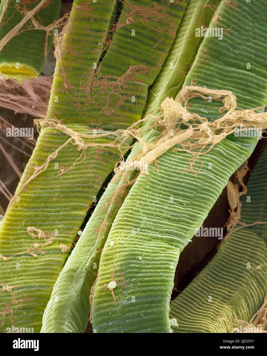 Coloured scanning electron micrograph (SEM) of tendons and other ...