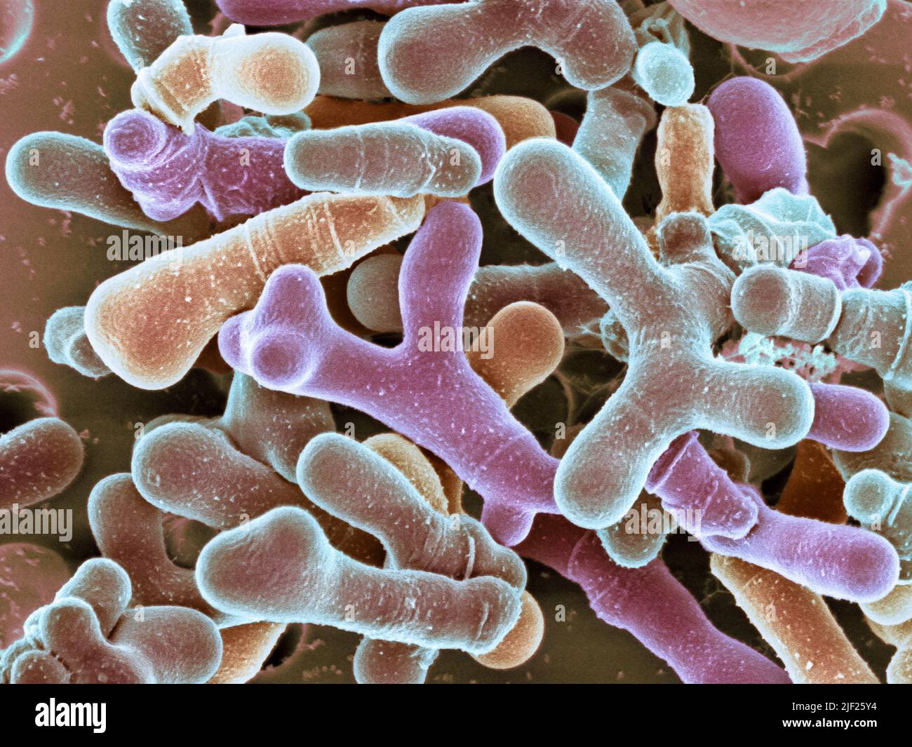 Coloured scanning electron micrograph (SEM) of Bifidobacterium animalis probiotic bacteria from ...