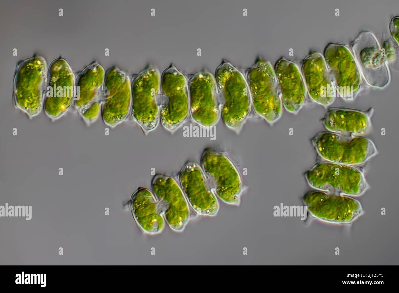 Differential interference contrast (DIC) light micrograph of Onychonema ...