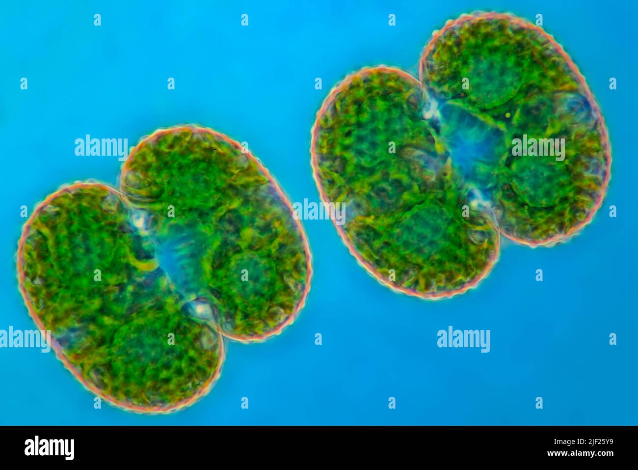 Light micrograph of Cosmarium reniforme sp. algae. Interphako contrast ...
