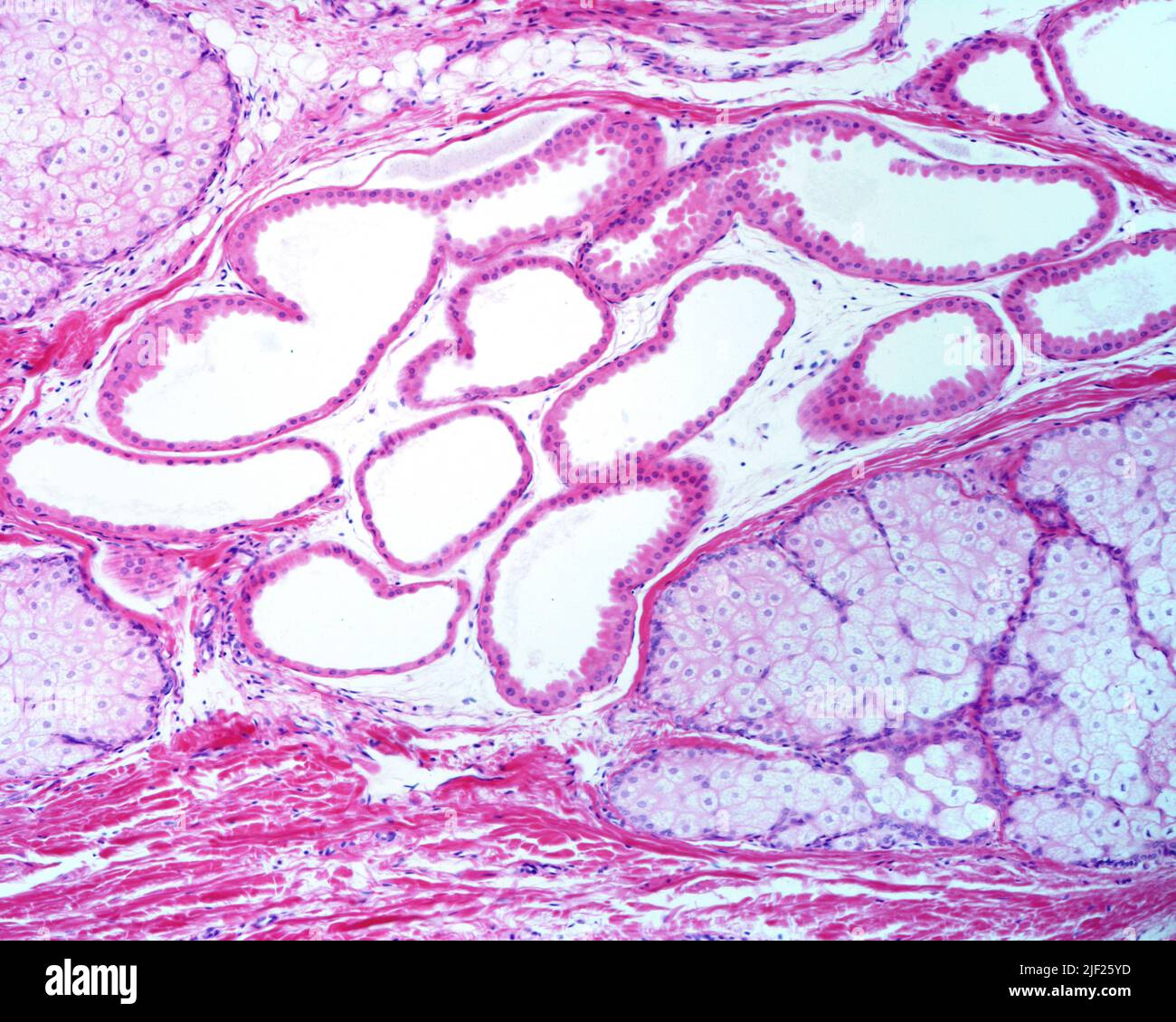 Light micrograph of secretory units of apocrine sweat (centre) and ...