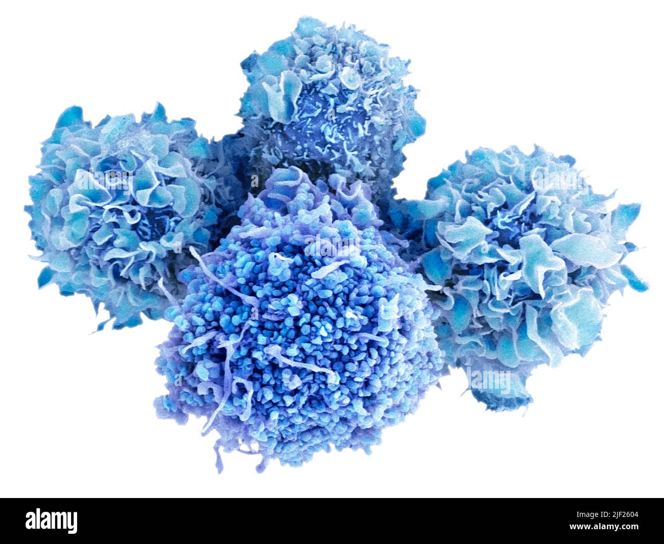 Coloured scanning electron micrograph (SEM) of human dendritic cells ...