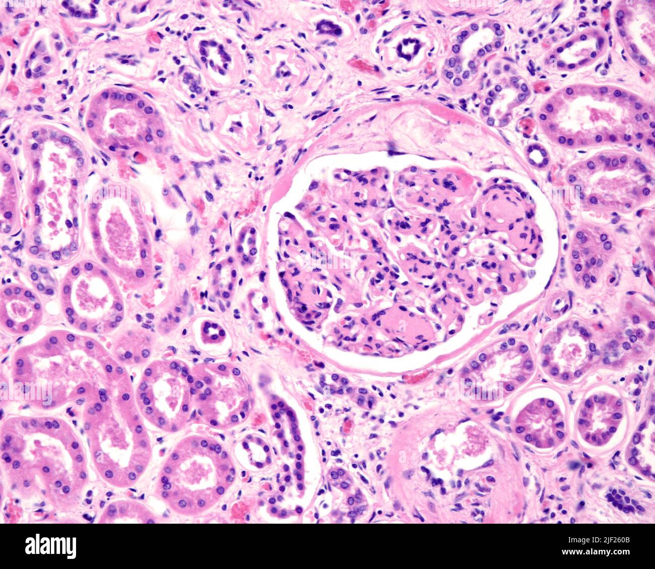 Glomerular Basement Membrane Histology