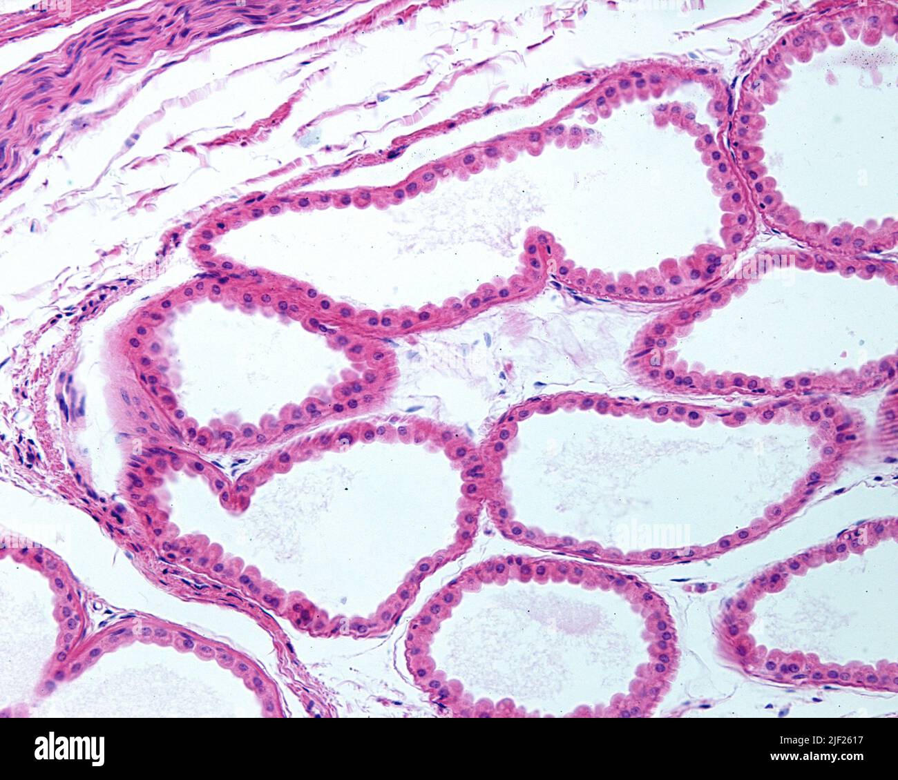 Light micrograph of secretory units of apocrine sweat glands showing ...
