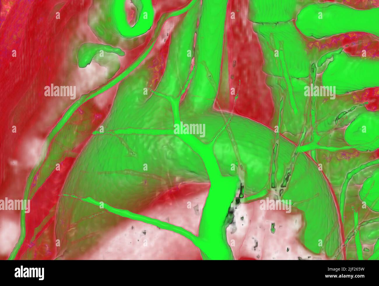 Coloured 3D computed tomography (CT) scan of a healthy aortic arch ...
