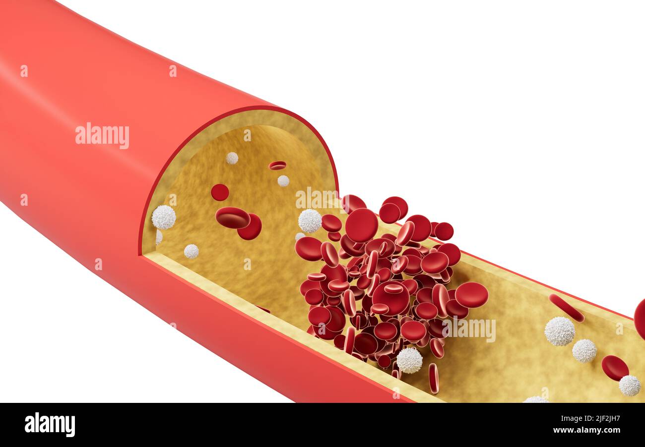Red and white blood cells in blood vessels, 3d rendering. Computer ...