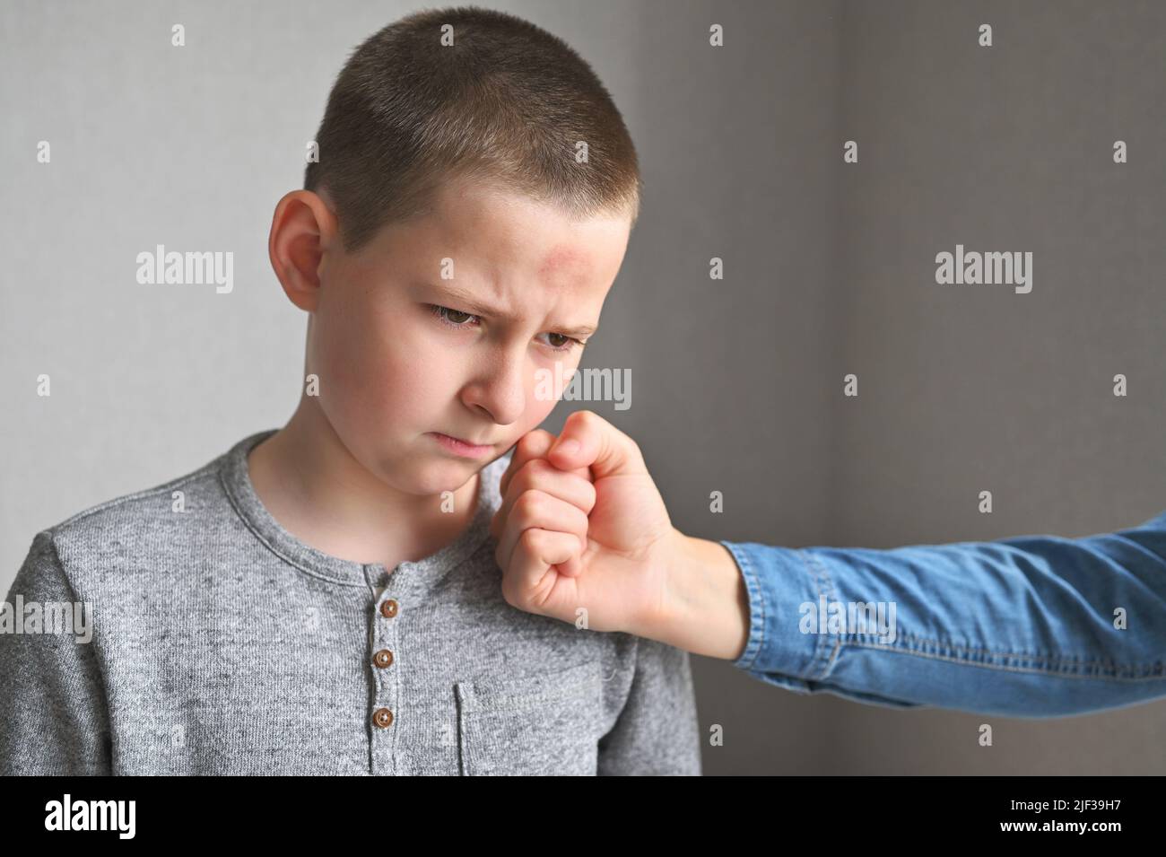 Fist of a parent near the face of a child with a bruise on his forehead ...