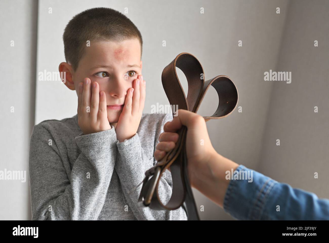 Boy bruise hi-res stock photography and images - Alamy