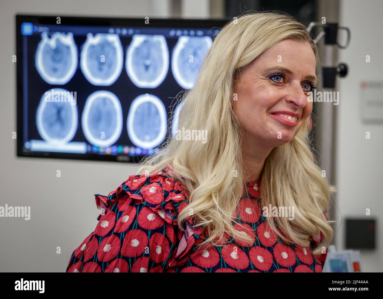 Nurse Carol Kenney describes her part in the largest stroke clinical ...