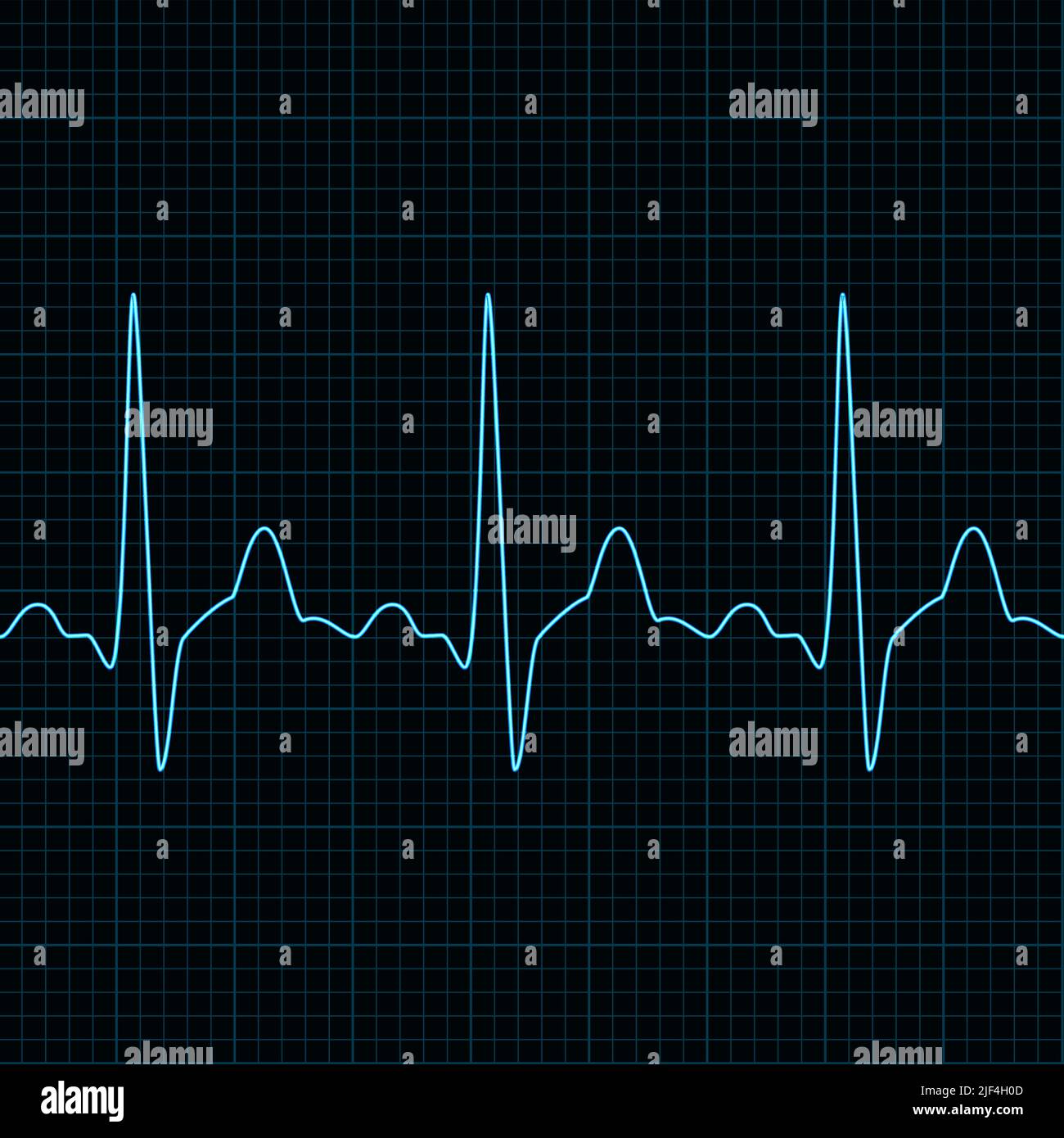 Heart beat ecg or ekg seamless neon line on blue background ...