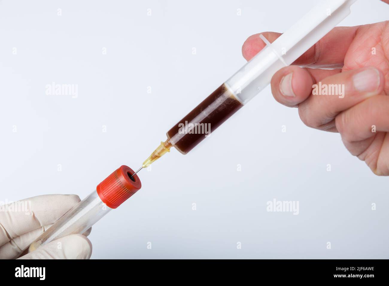 Handling blood probes with syringe and test tube for analyzing to in a ...