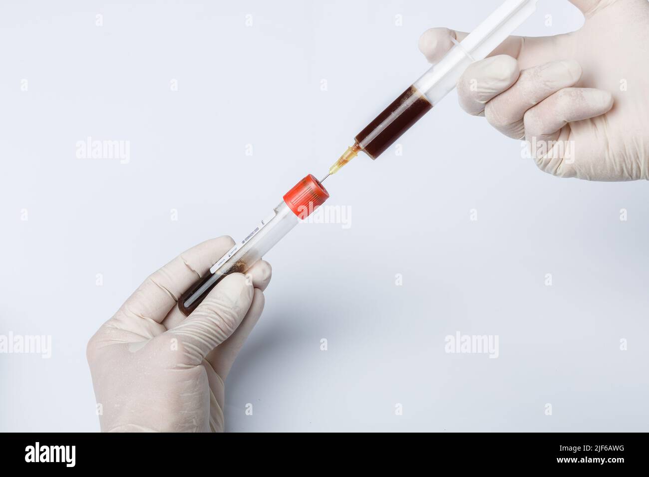 Blood serum hi-res stock photography and images - Alamy