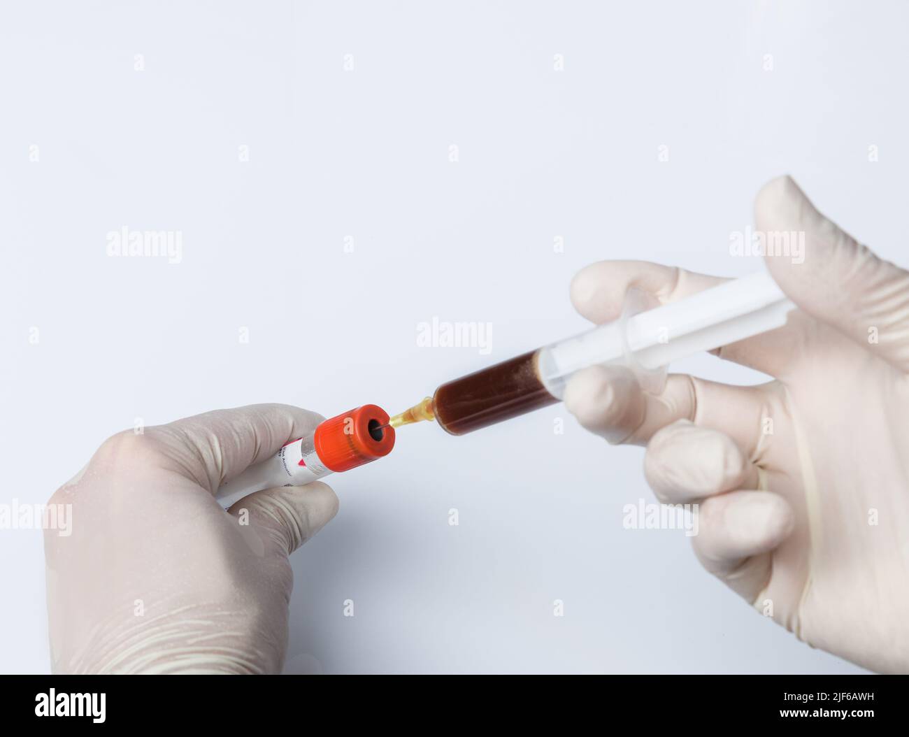 Blood test tube syringe hi-res stock photography and images - Alamy