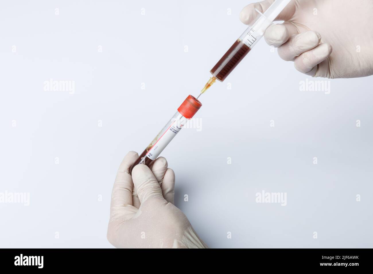 Handling blood probes with syringe and test tube for analyzing to in a ...