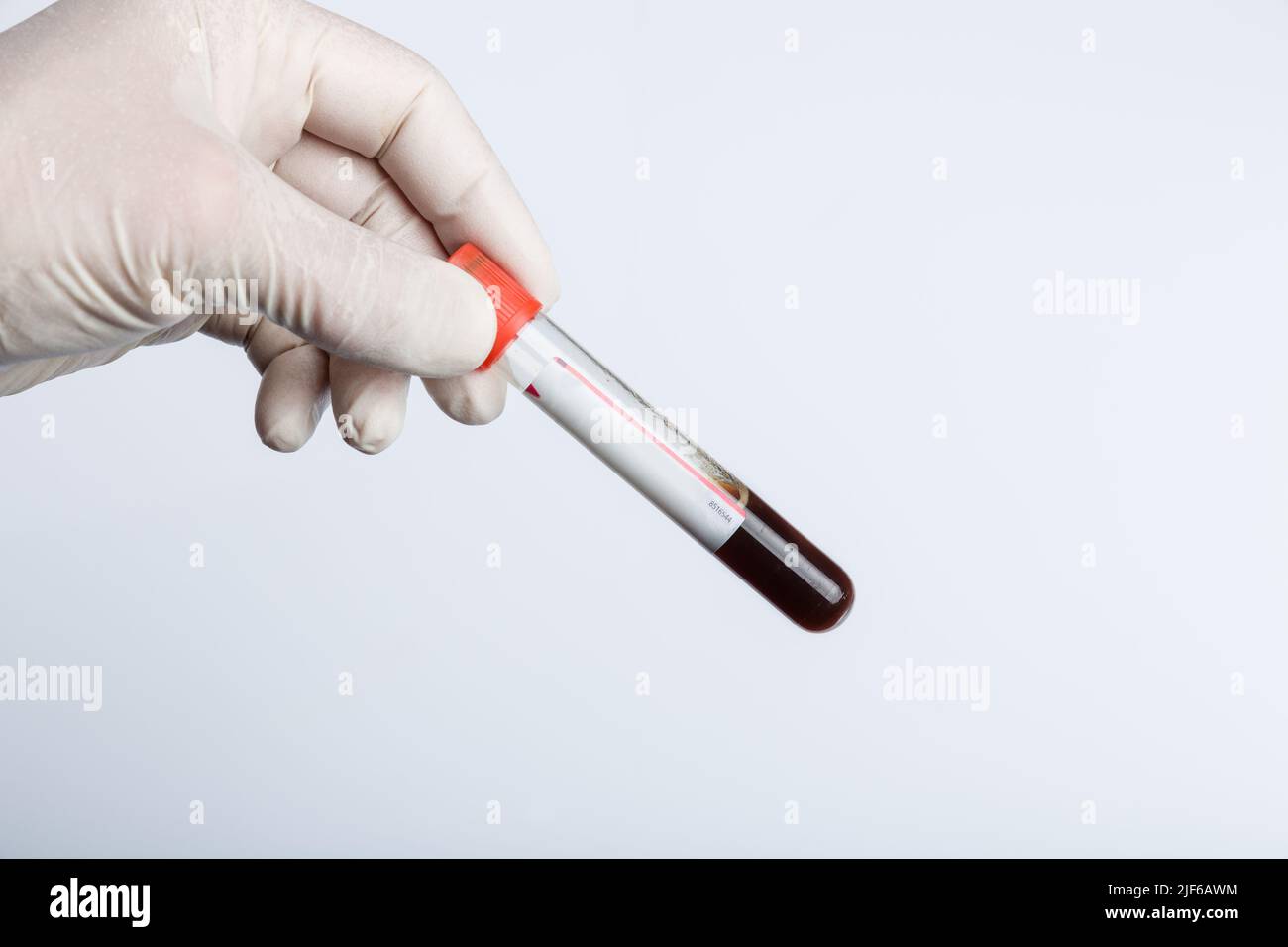 close-up of a hand in medical gloves handling a blood probe Stock Photo ...
