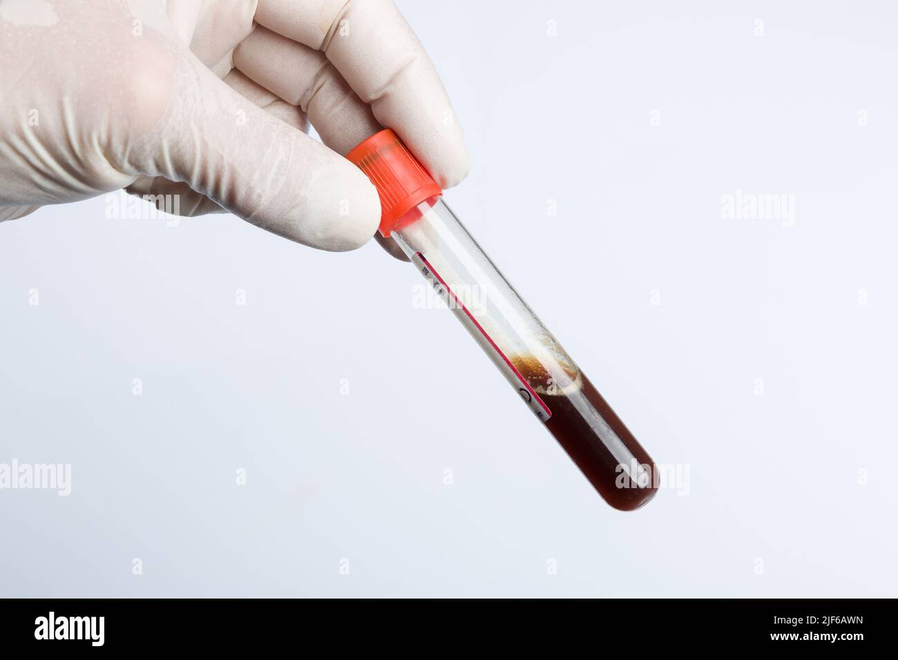 Specimen tube handling hi-res stock photography and images - Alamy