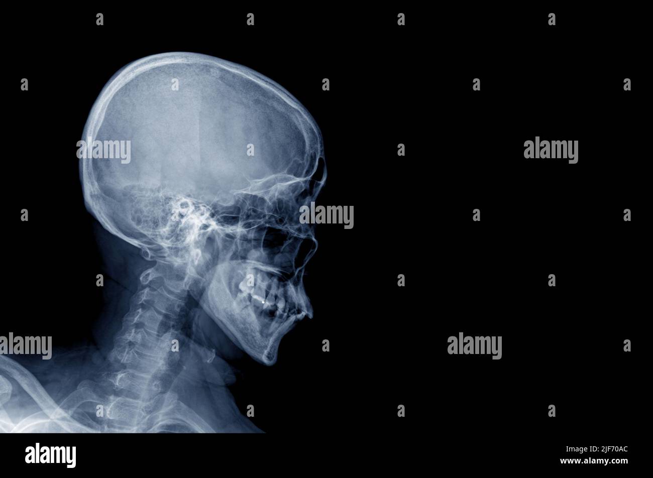 Human skull front view hi-res stock photography and images - Alamy